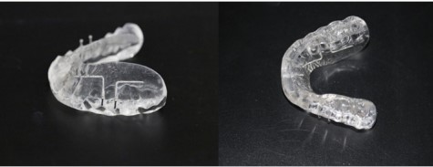 Hegab Academt-Hegab TMJ Splint (HTS)